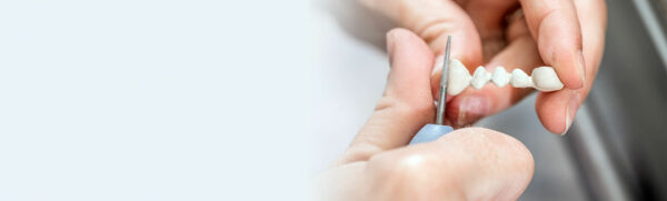 Zahnreparatur & Zahnrestauration in Eckernförde | Praxisverbund DDent